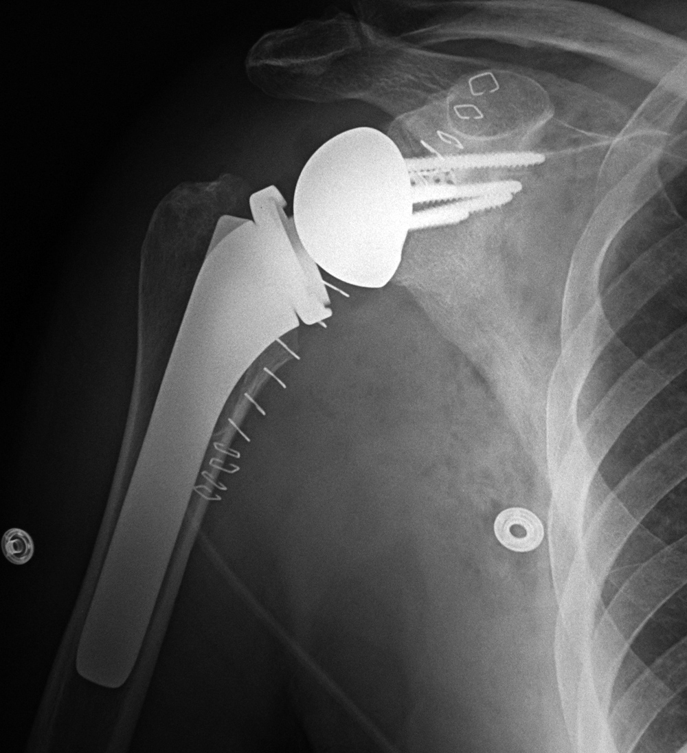 Medical Apparatus Imaging Guide Joint Arthroplasty