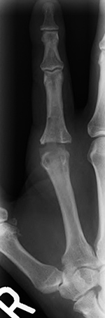 Medical Apparatus Imaging Guide: joint arthroplasty