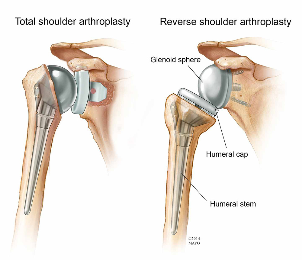 Medical Apparatus Imaging Guide Joint Arthroplasty