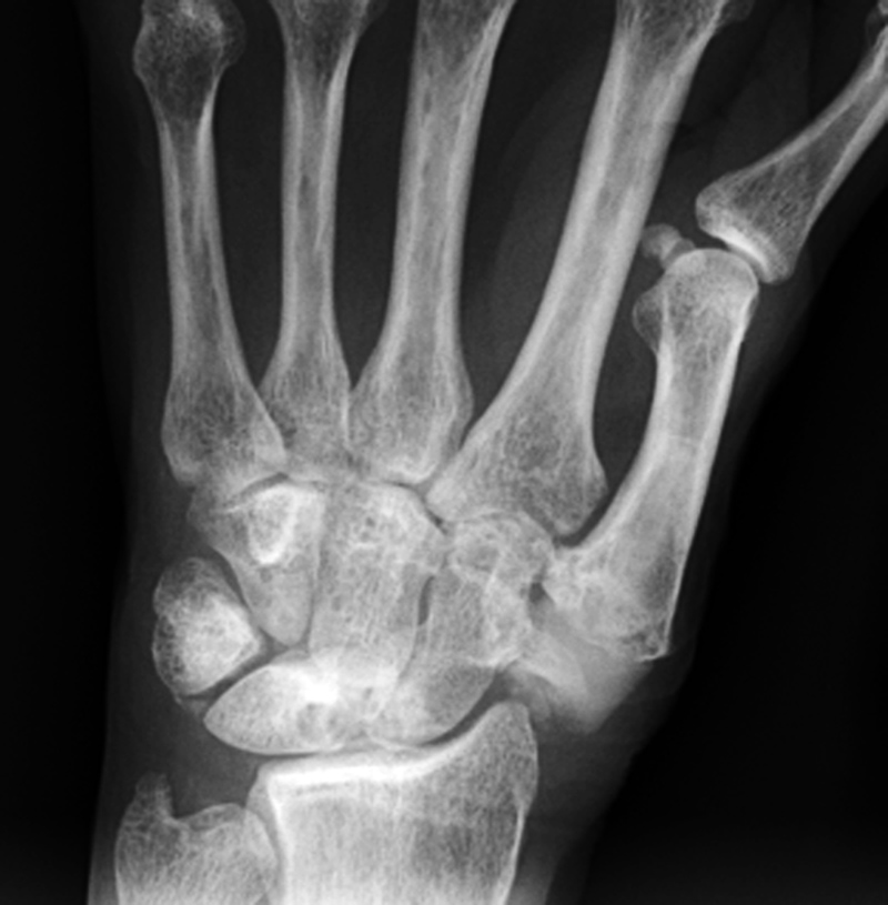 Medical Apparatus Imaging Guide: joint arthroplasty