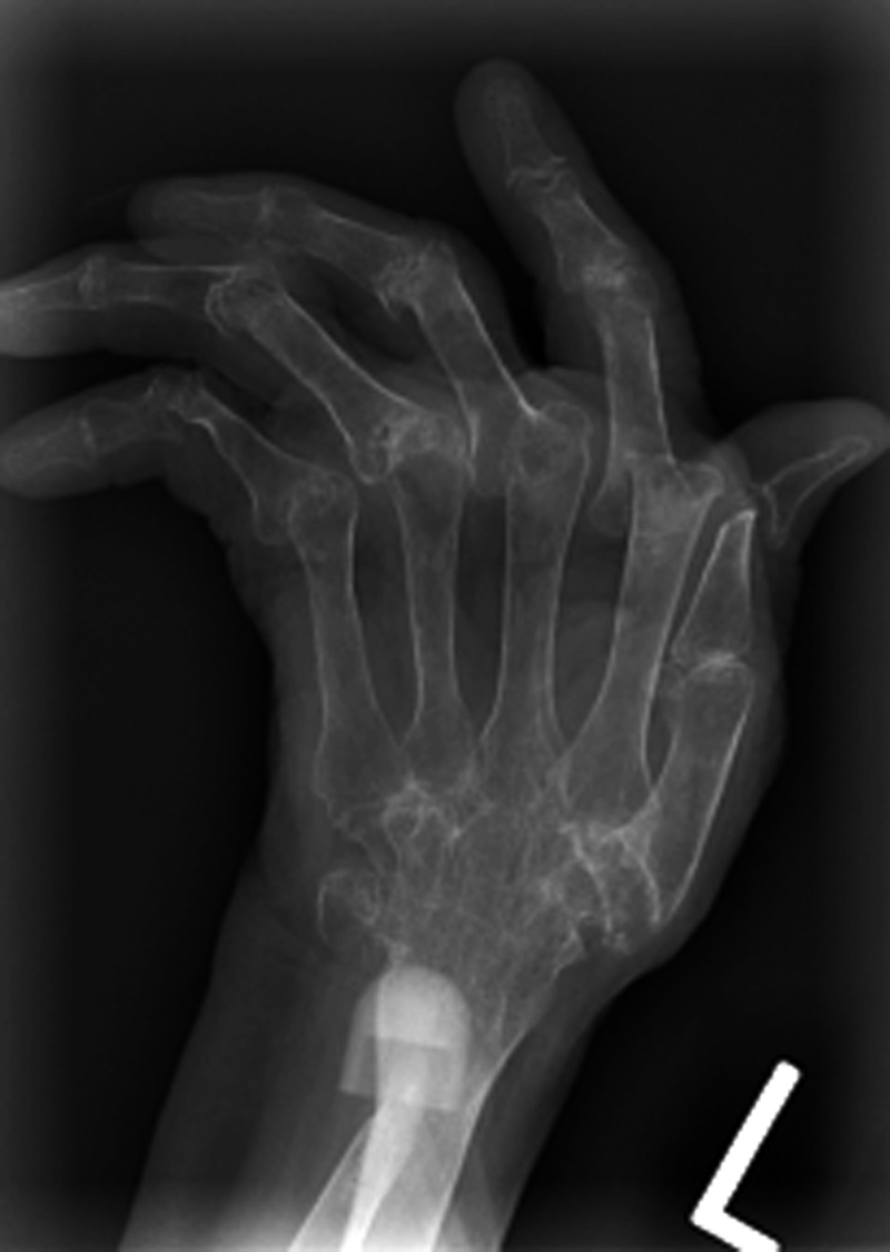 Medical Apparatus Imaging Guide: joint arthroplasty