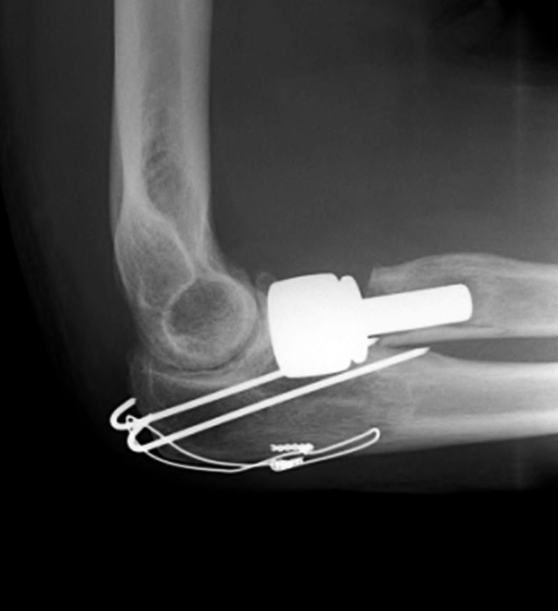 Medical Apparatus Imaging Guide: joint arthroplasty